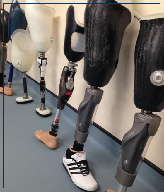 Gatewood Prosthetics